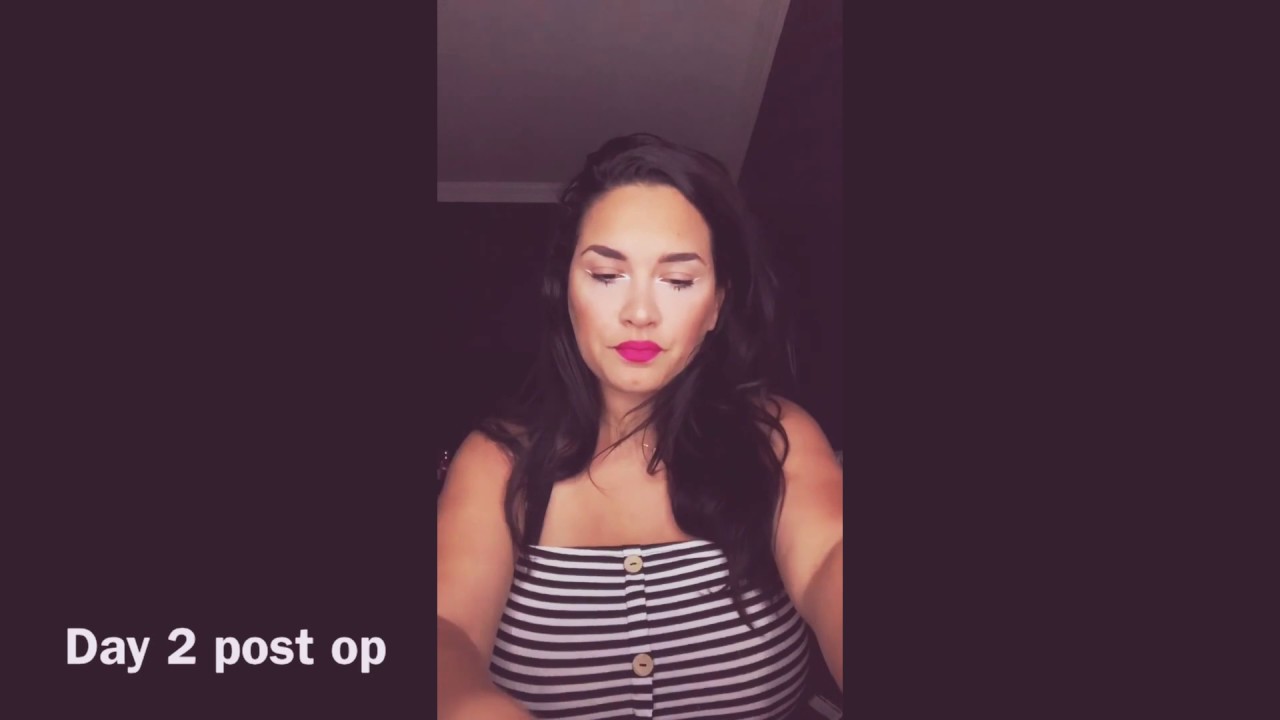Day 2 post op tummy tuck & lipo - YouTube