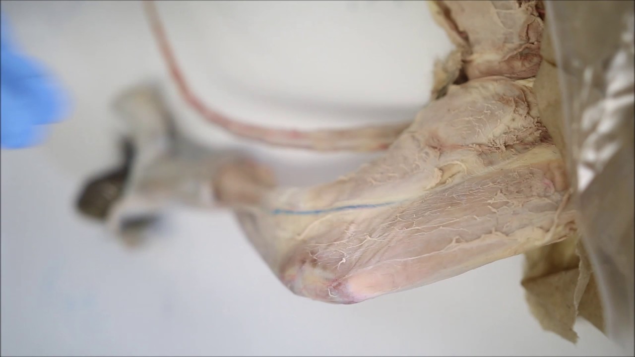 Anatomy Project - Leg Muscles DIssection - YouTube