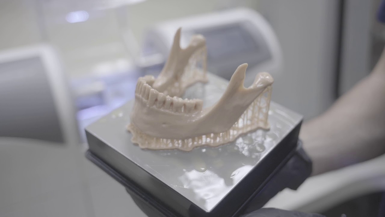 Digital workflow dentistry - YouTube