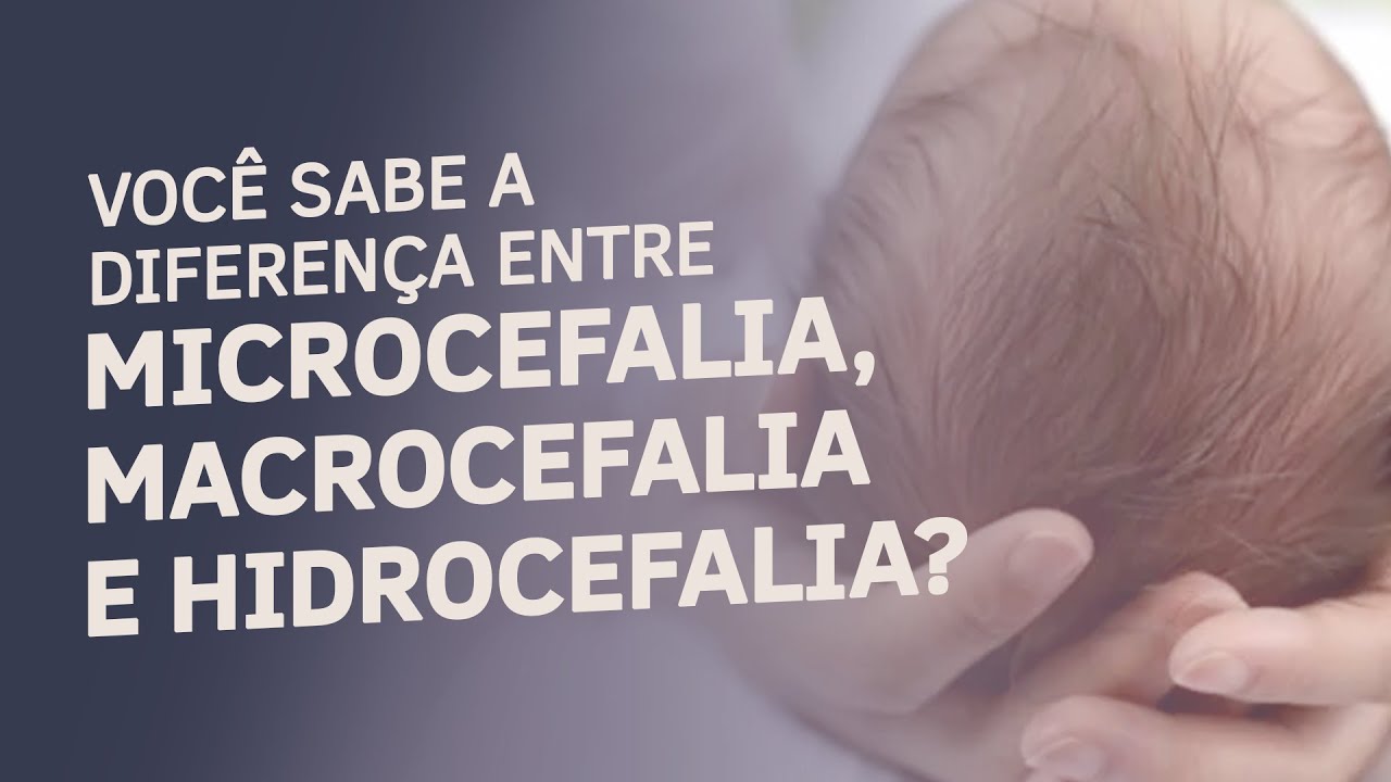 Microcefalia, Macrocefalia e Hidrocefalia: Diferenças, Causas e ...