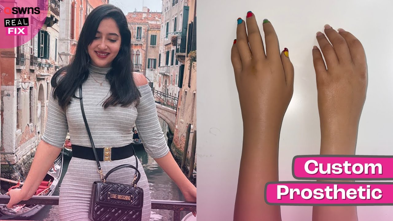 "I was born without my left arm - now I have a bionic arm with custom ...