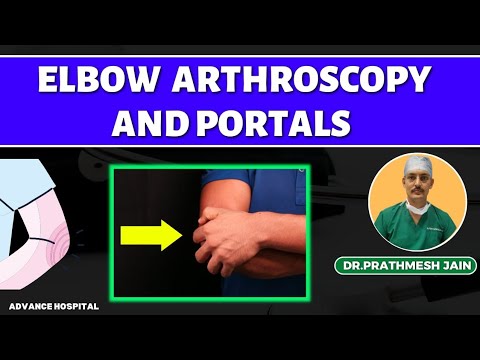 Elbow Arthroscopy and portals - YouTube