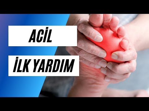 Ayağa Batan Cam Nasıl Çıkarılır? Hızlı ve Güvenli Yöntemler!