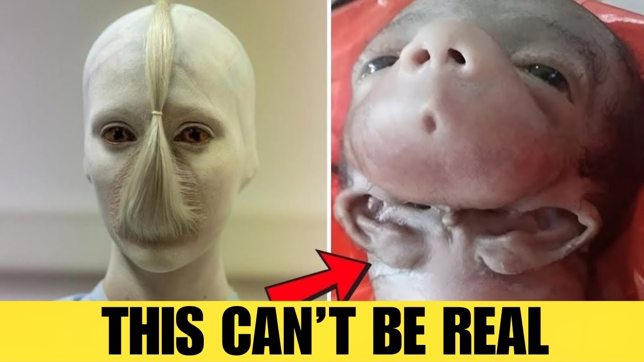 These 10 Humans Don’t Seem Real… But They Are | Then and Now 2026 - YouTube