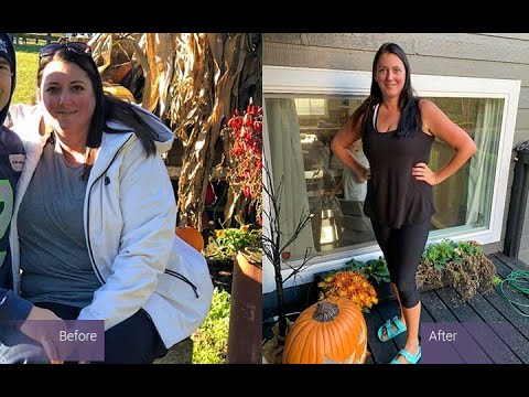 Misty's ESG Weight Loss Journey | Patient Spotlight Fall 2020 - YouTube