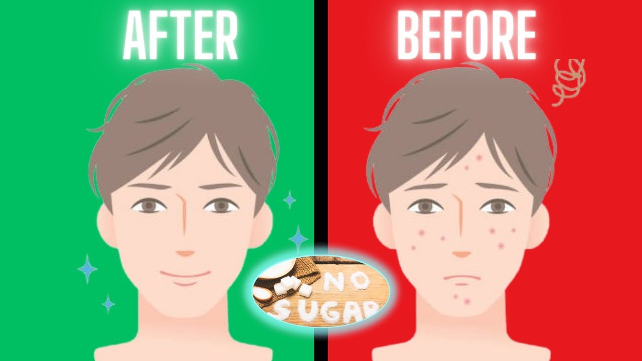 The Effects on Your Body After 7 Days of Sugar Abstinence!! - YouTube