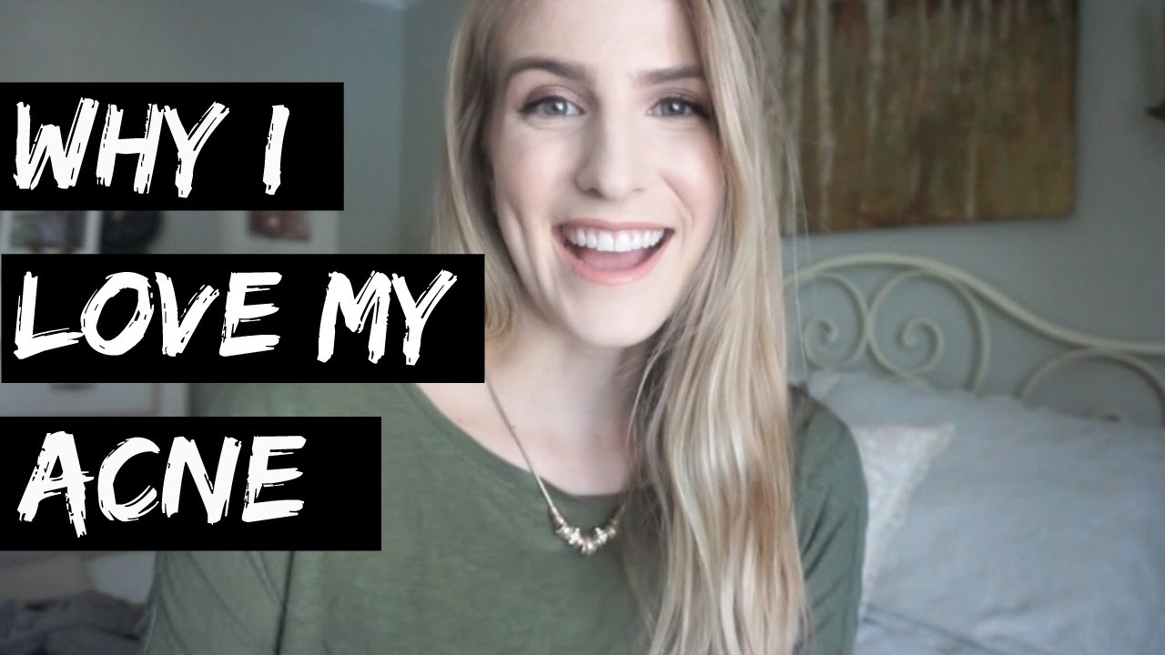 WHY I LOVE MY ACNE - YouTube