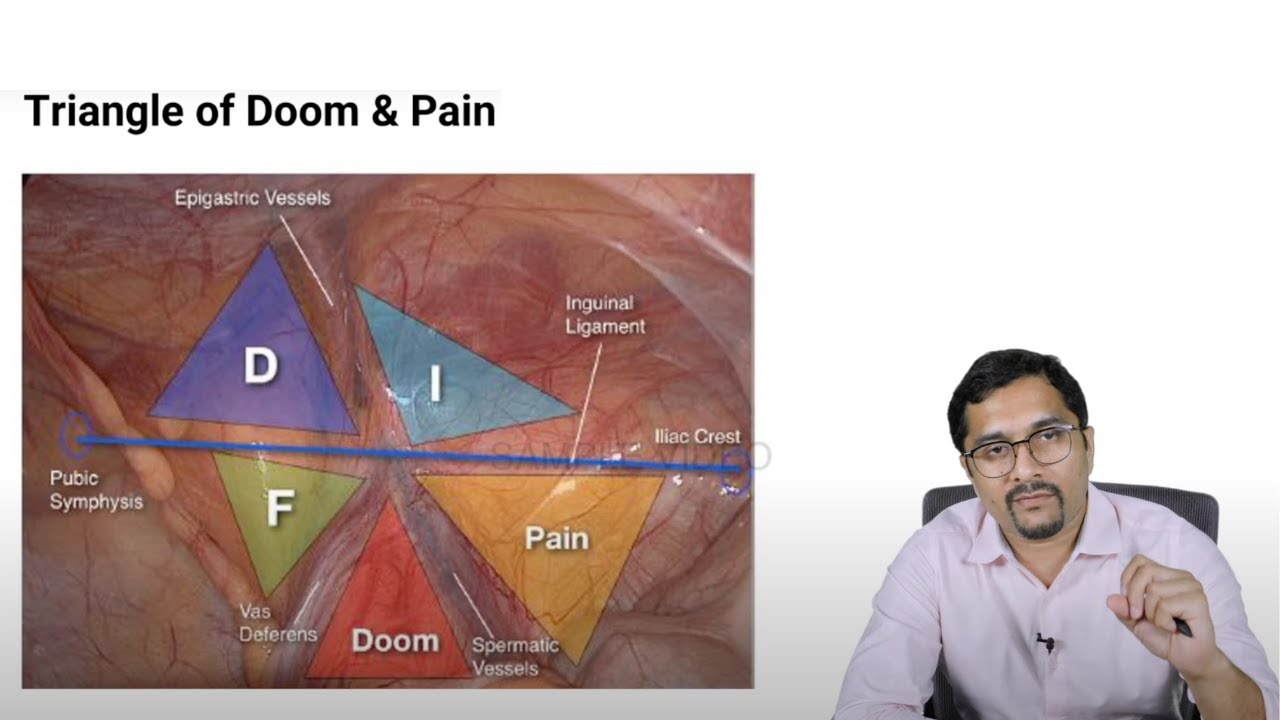 Triangle Of Doom And Pain