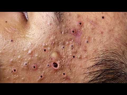 العناية بالبشرة الفاخرة اليومية للوجه مع وكالة ناسا