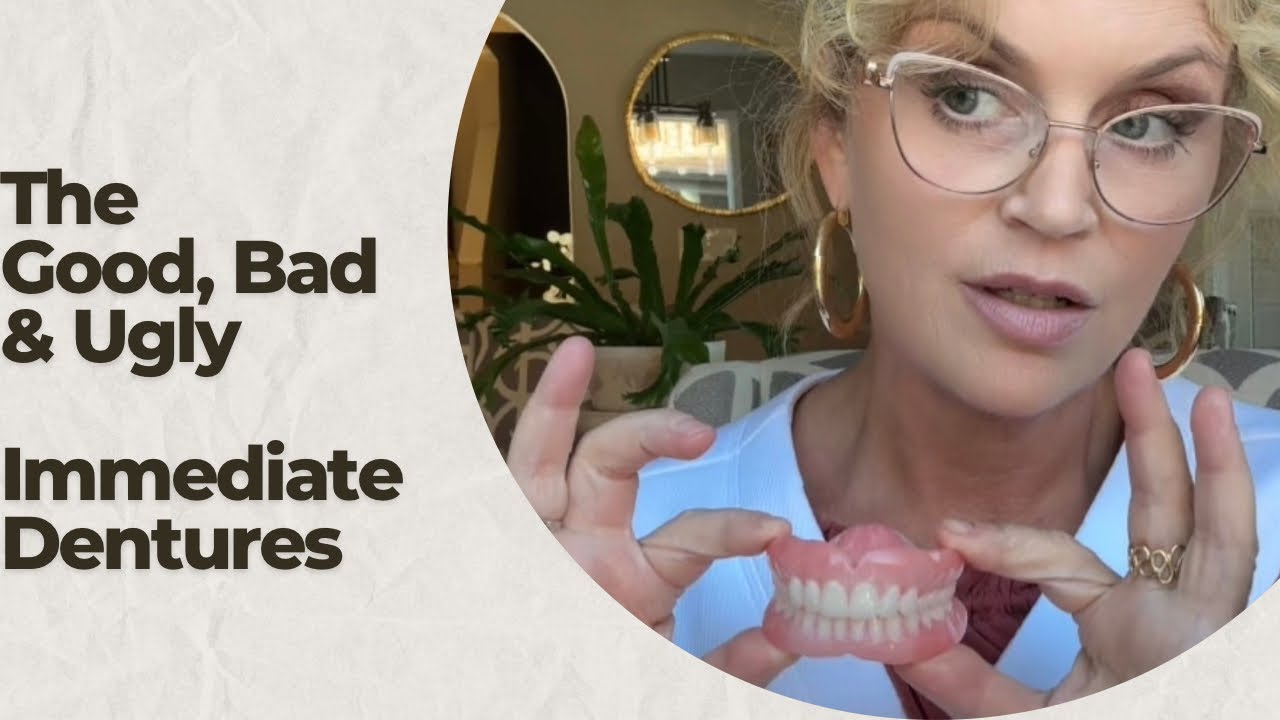 The Good, The Bad and The Ugly of Immediate Dentures - YouTube