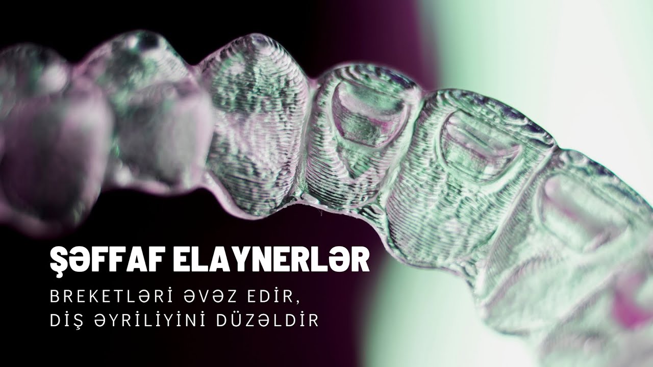 BAKIDA ELAYNER KAPALAR BREKETLER / MEDHOLDING KLINIKA - YouTube