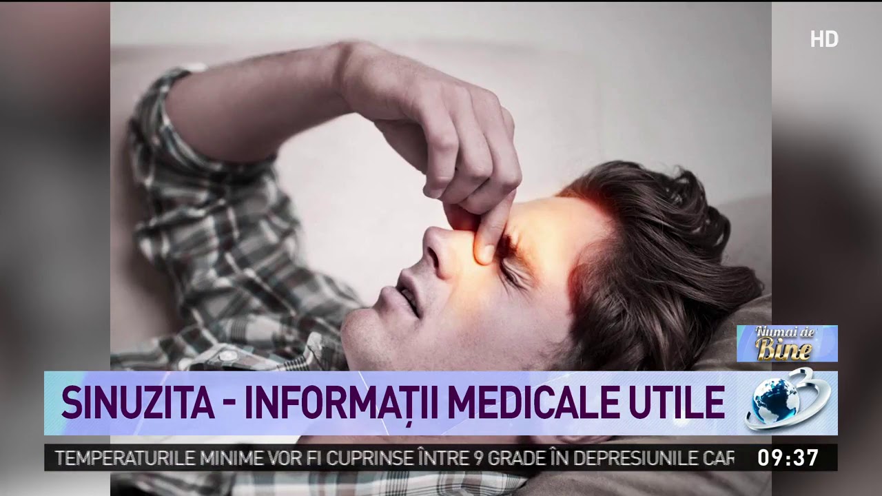 Sinuzita - informații medicale utile - YouTube
