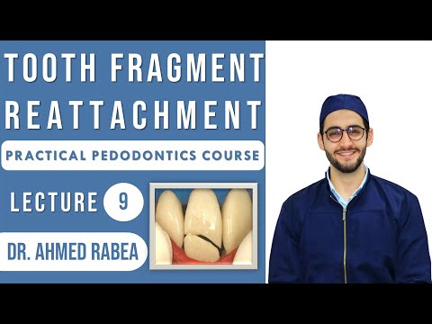 Lecture 09 : Tooth Fragment Reattachment | كورس بيدو عملي - YouTube