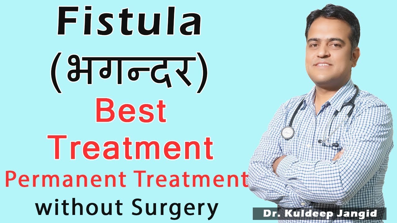 Best treatment of Fistula (भगन्दर) without operation | Fistula का 100% ...
