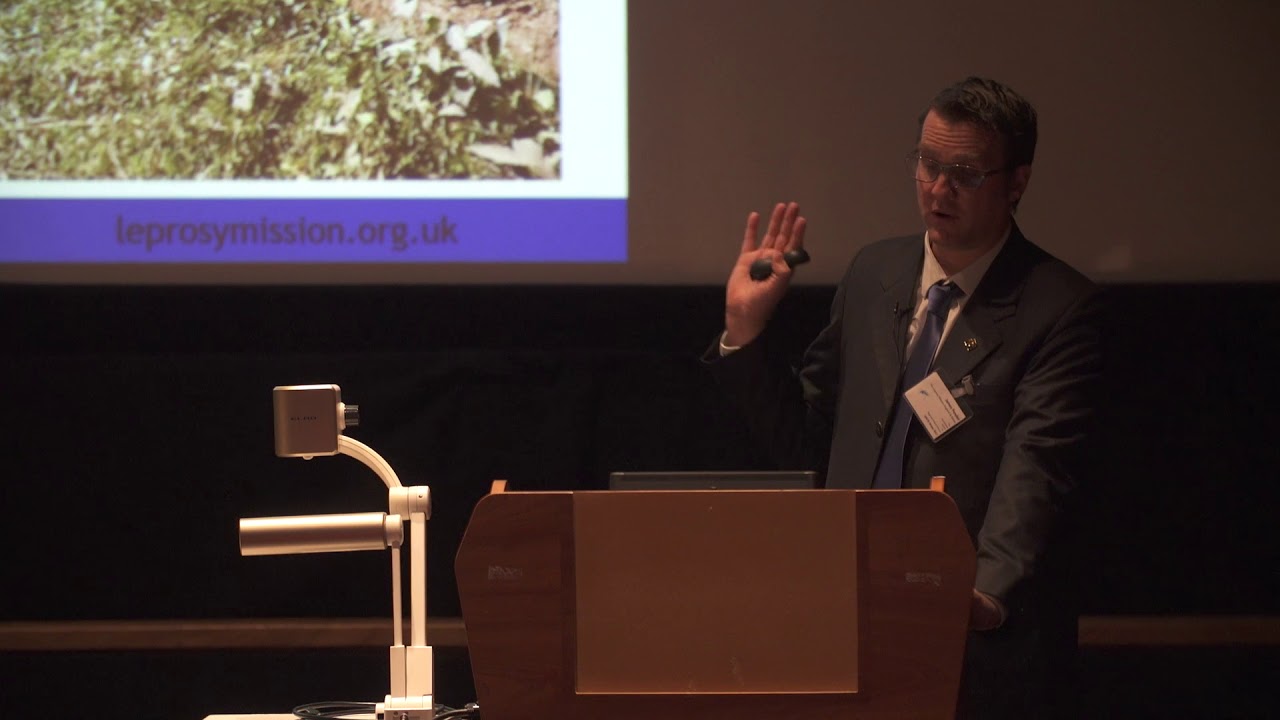James Pender (The Leprosy Mission England & Wales): WASH in Leprosy ...