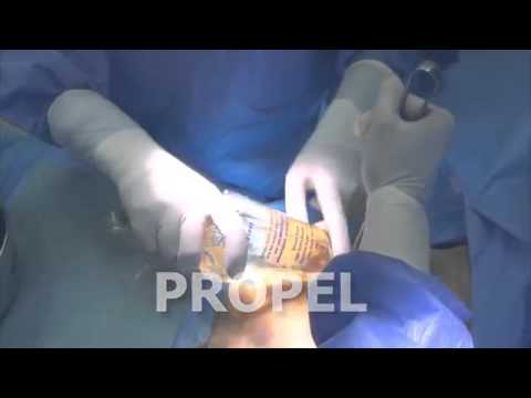 Keller Funnel 2 - YouTube