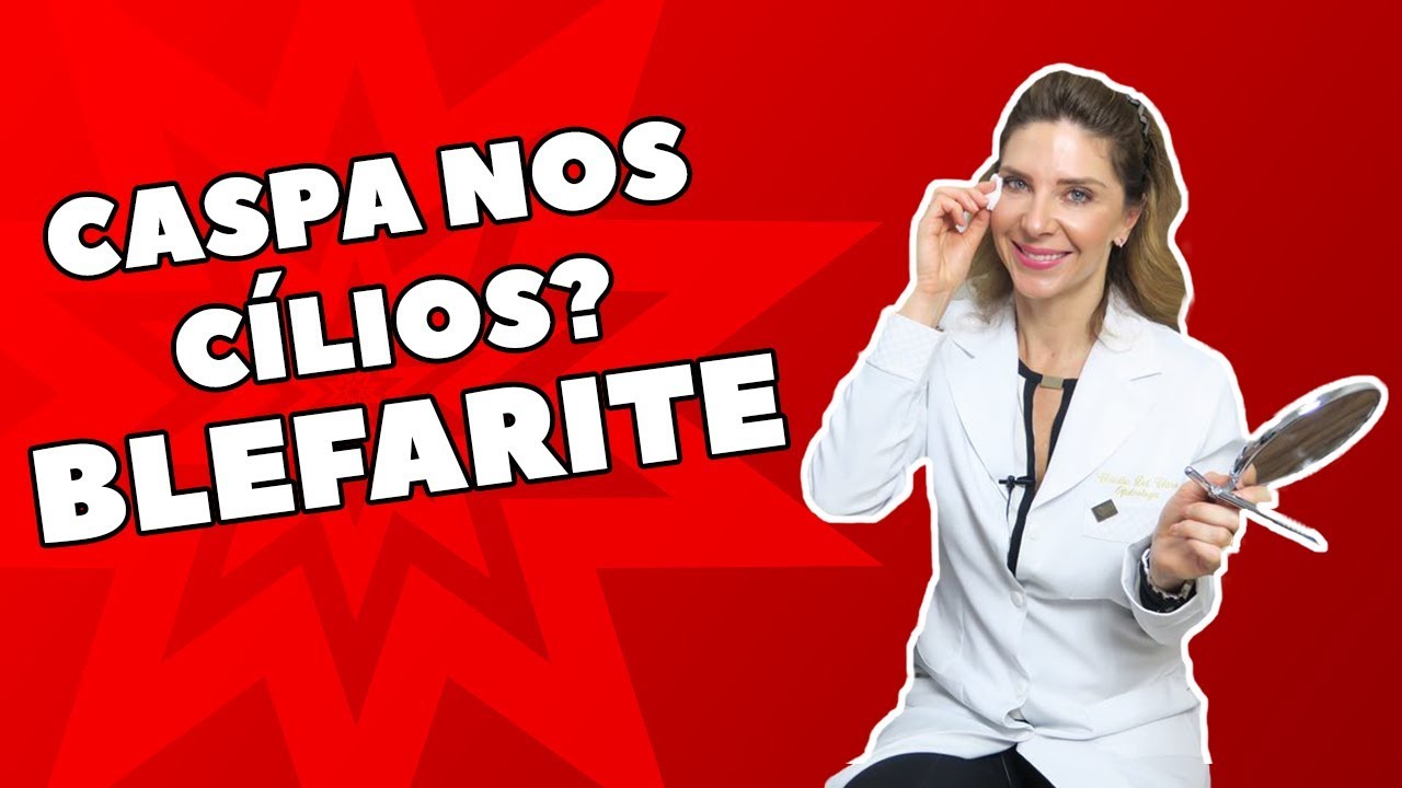 Blefarite - Como Tratar Blefarite - YouTube