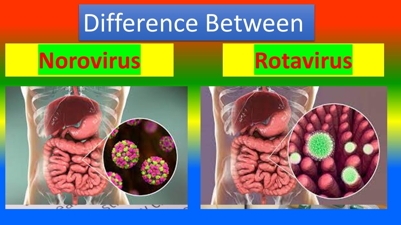 Difference Between Norovirus And Rotavirus YouTube difference-between-norovirus-and-rotavirus-youtube