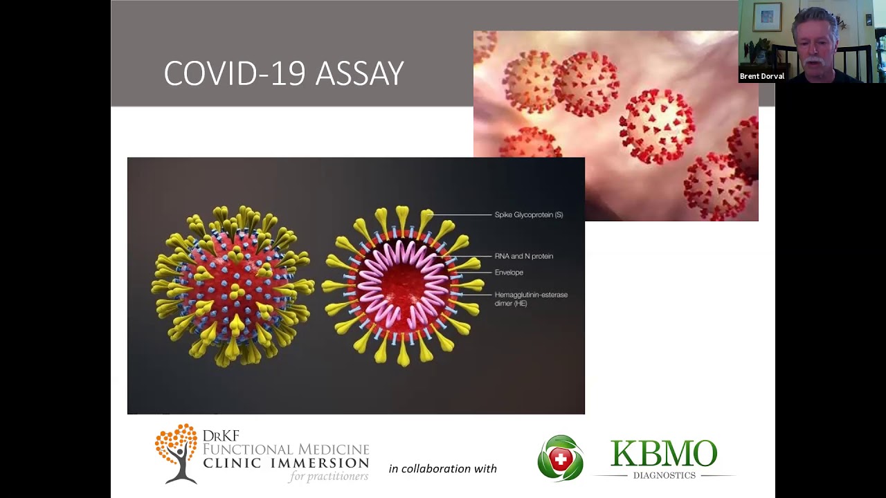 New IgG IgM Antibody Test for COVID 19 from KBMO Diagnostics - YouTube