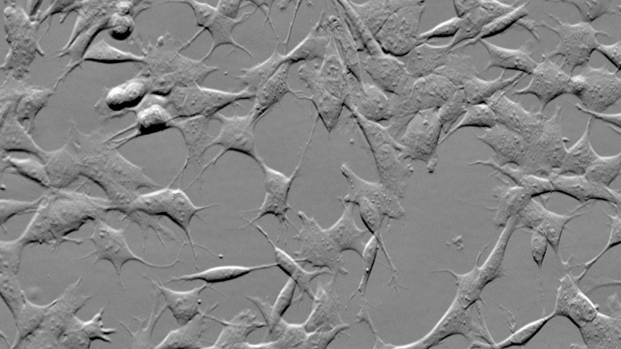 Brain Cells Under A Microscope A Novel Discovery Hints At Why We Stop