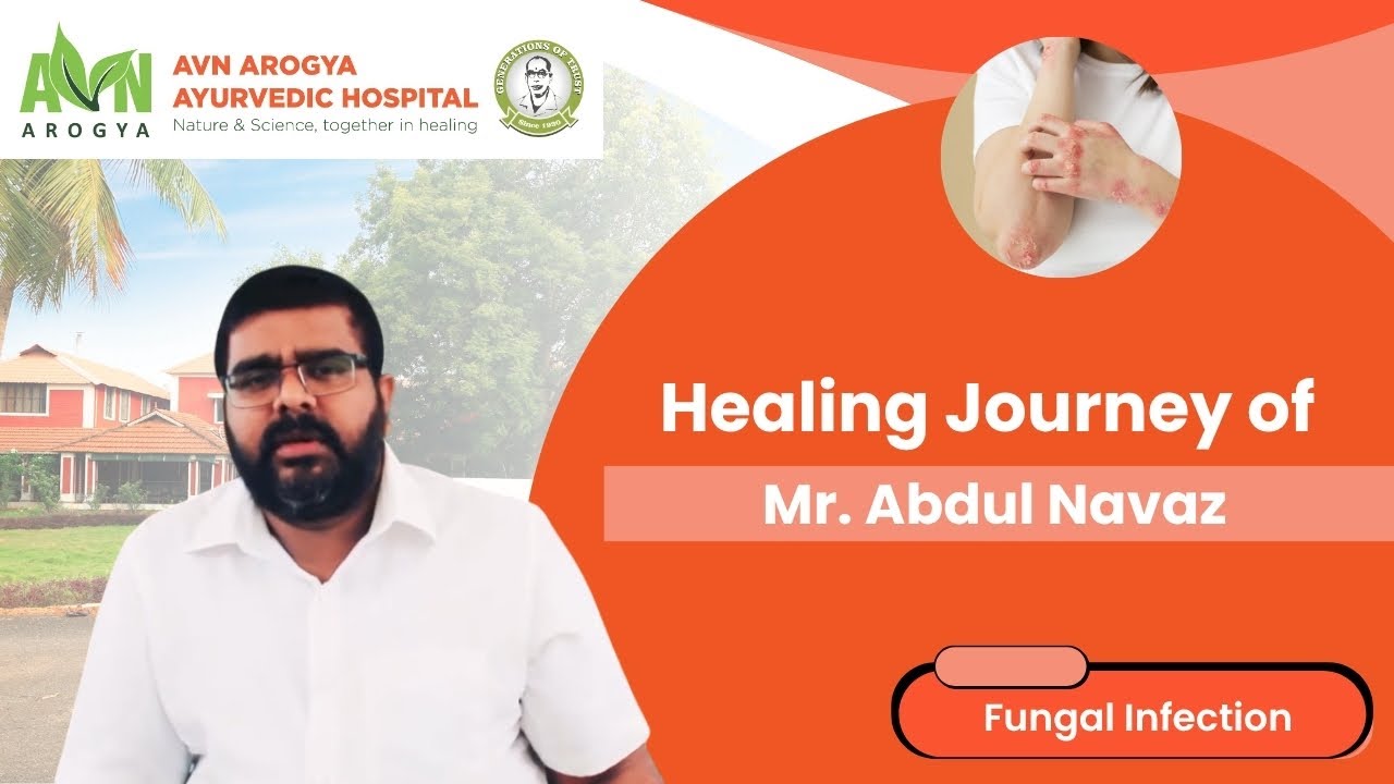 Healing Fungal Infection Naturally | Mr. Abdul Navaz’s Story at AVN ...