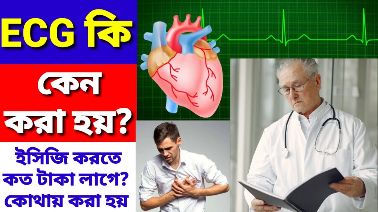 ECG ki? ECG kivabe kore? ইসিজি করতে কত টাকা লাগে? - YouTube