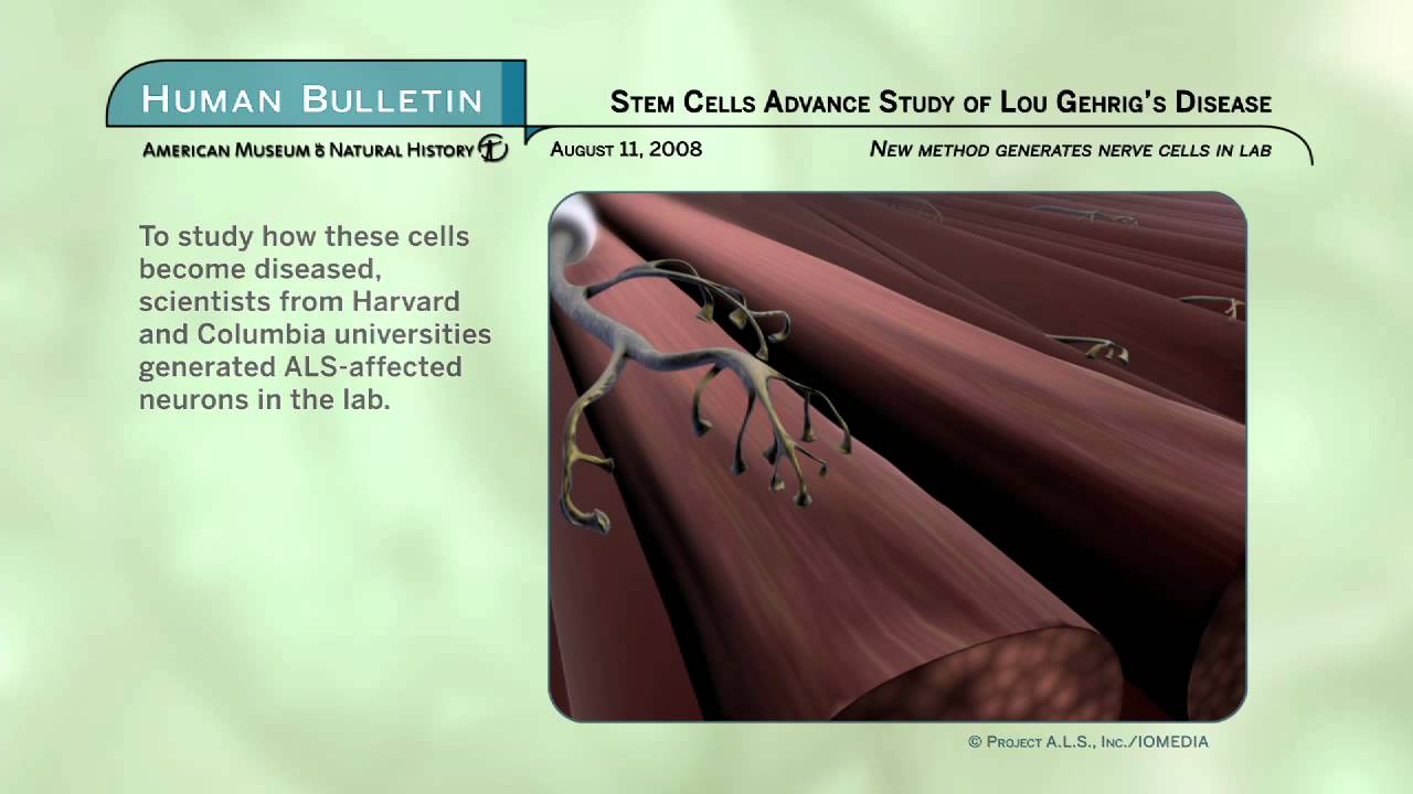 Science Bulletins: Stem Cell Advance Study of Lou Gehrig's Disease ...