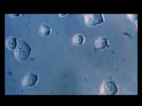 Stem cells death with phase contrast - YouTube