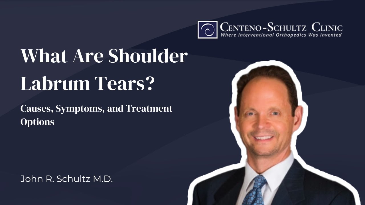 What Are Shoulder Labrum Tears? And What Are The Causes, Symptoms, and ...