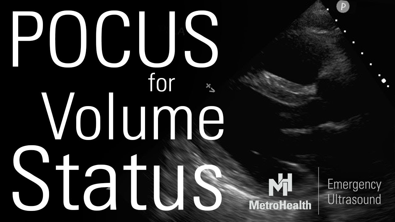 POCUS for Volume Status in Surgical Critical Care - YouTube