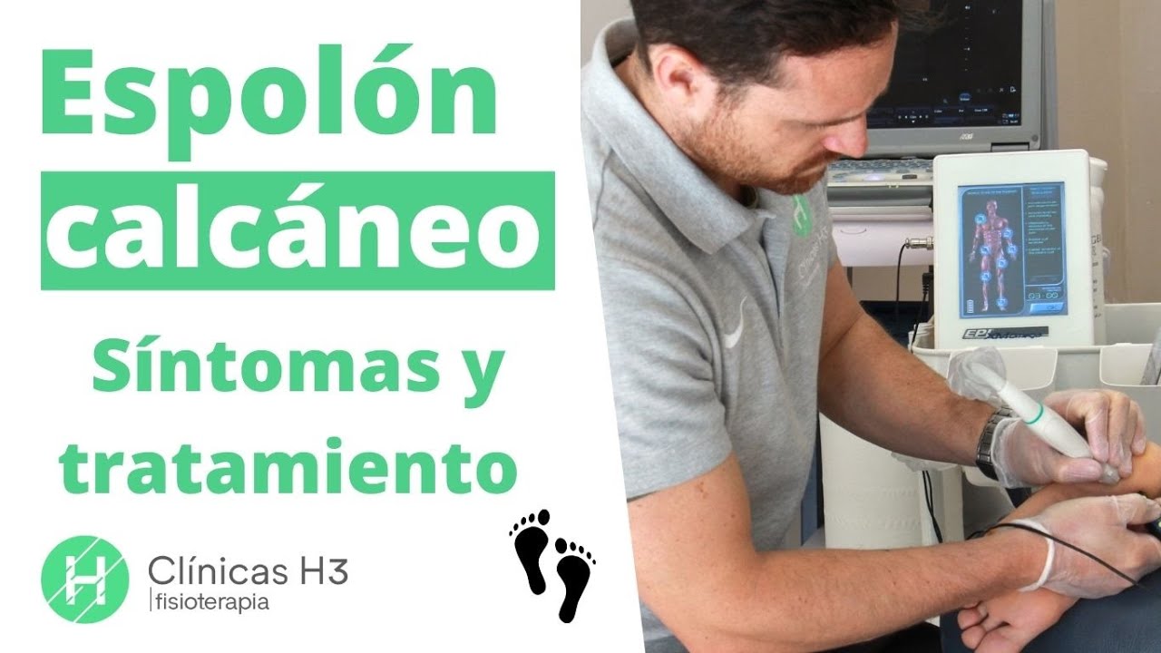Espolón calcáneo. Causas, síntomas y tratamientos👣 Espolon en pie👣 ...