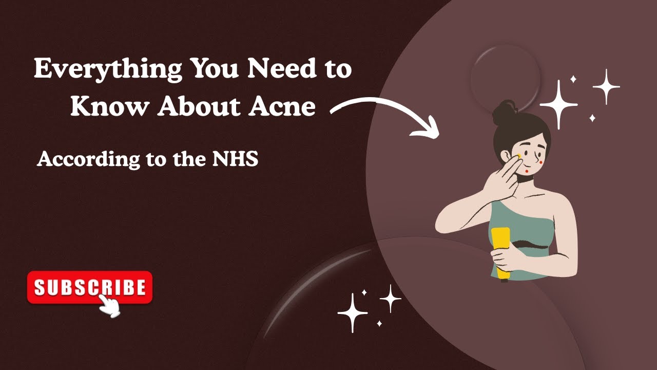 Everything You Need to Know About Acne — According to the NHS | Causes ...