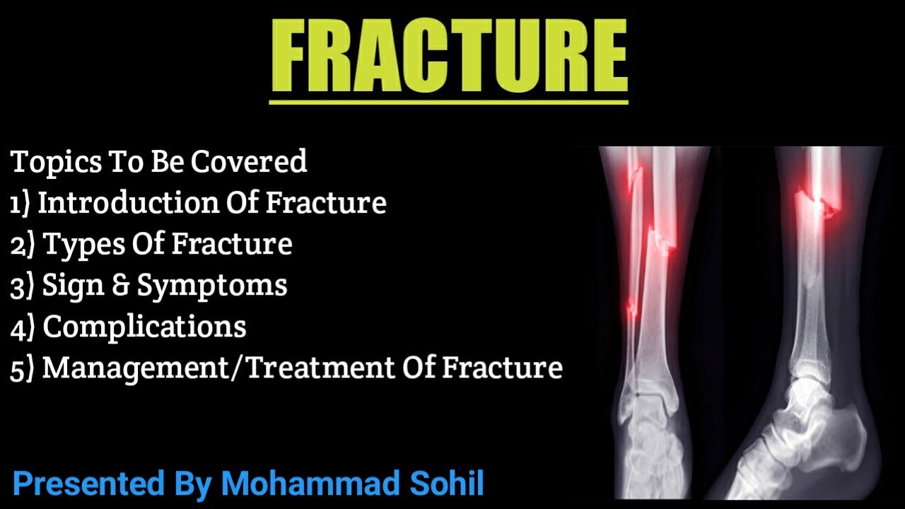 FRACTURES | Introduction, Types, Complications, Management Of Fracture ...