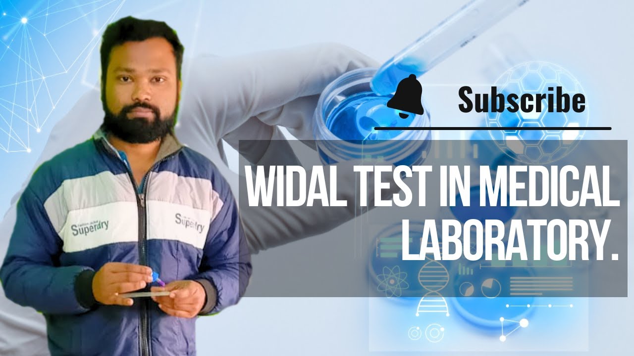 Understanding the Widal Test in Medical Laboratory: A Comprehensive ...