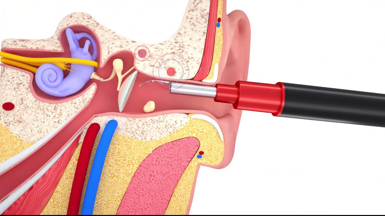 AMIGOBLUE Wireless Endoscope Ear Inspection tool - YouTube