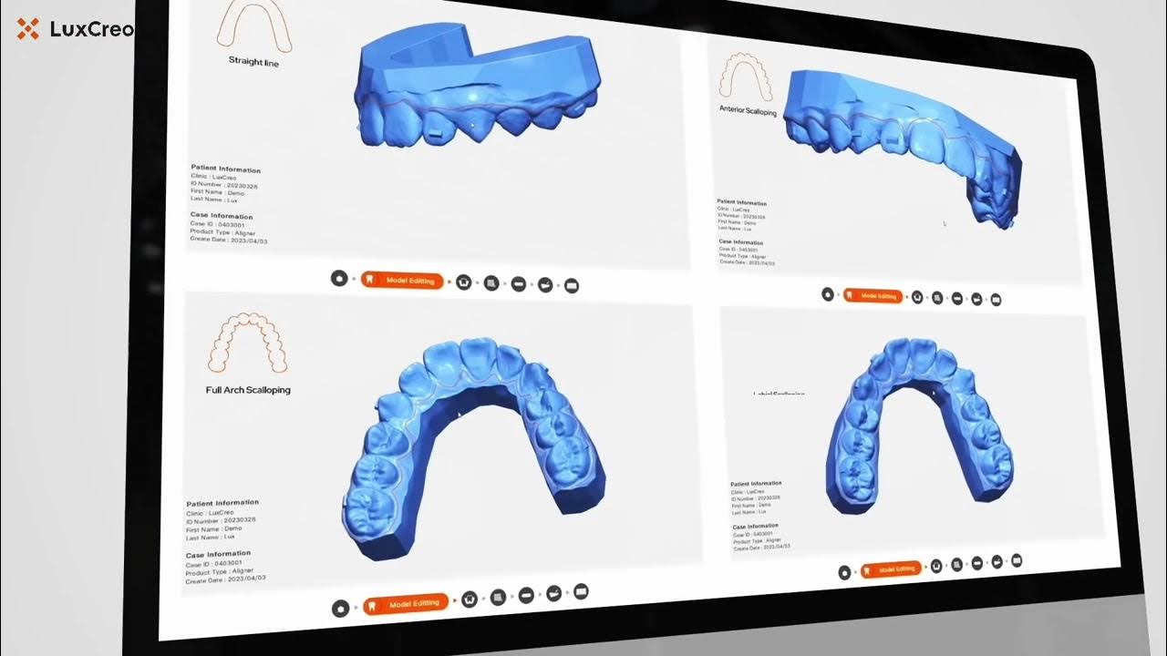 LuxCreo Design from 3DNA Dental - YouTube