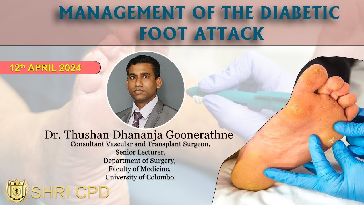 MANAGMENT OF THE DIABETIC FOOT ATTACK - YouTube
