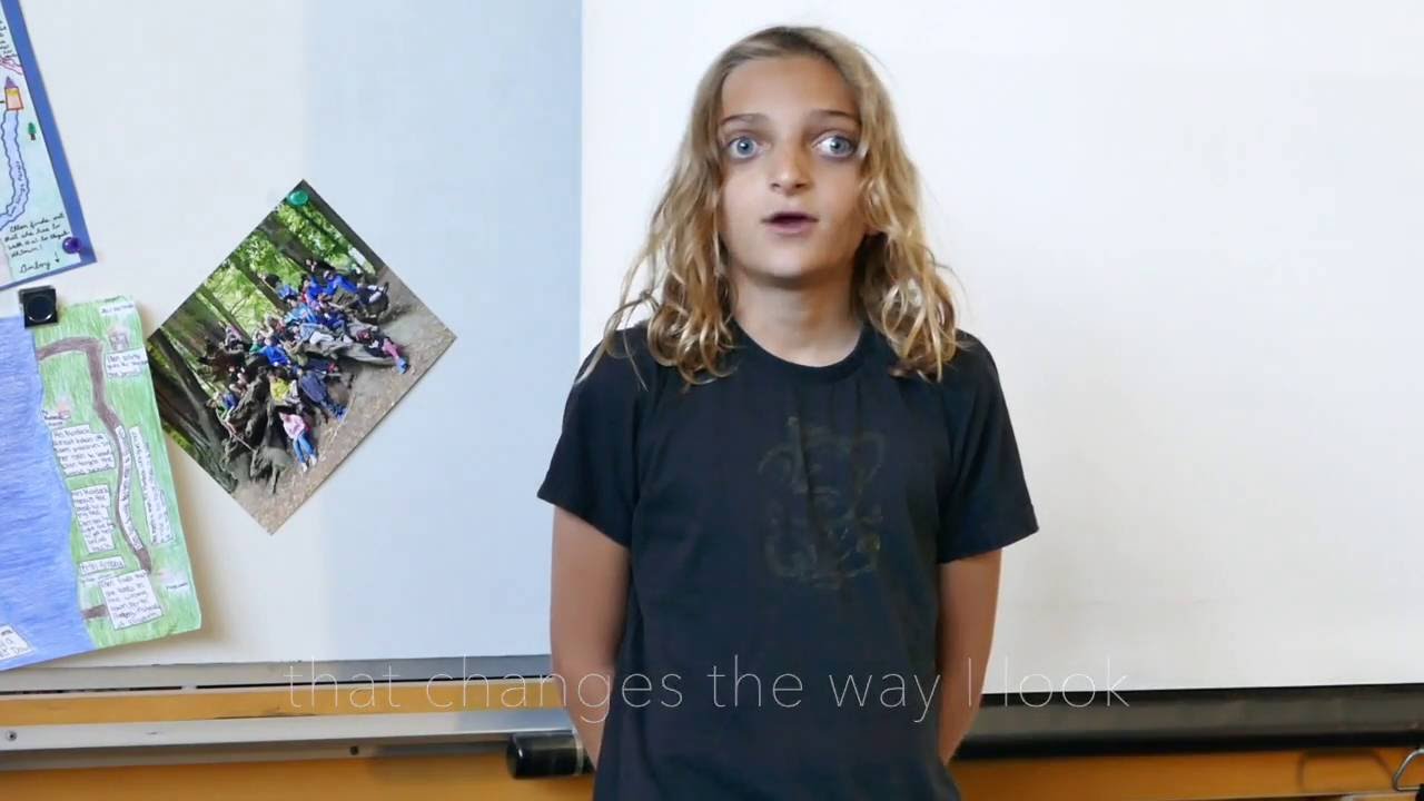 Charlie's Crouzon Story - YouTube