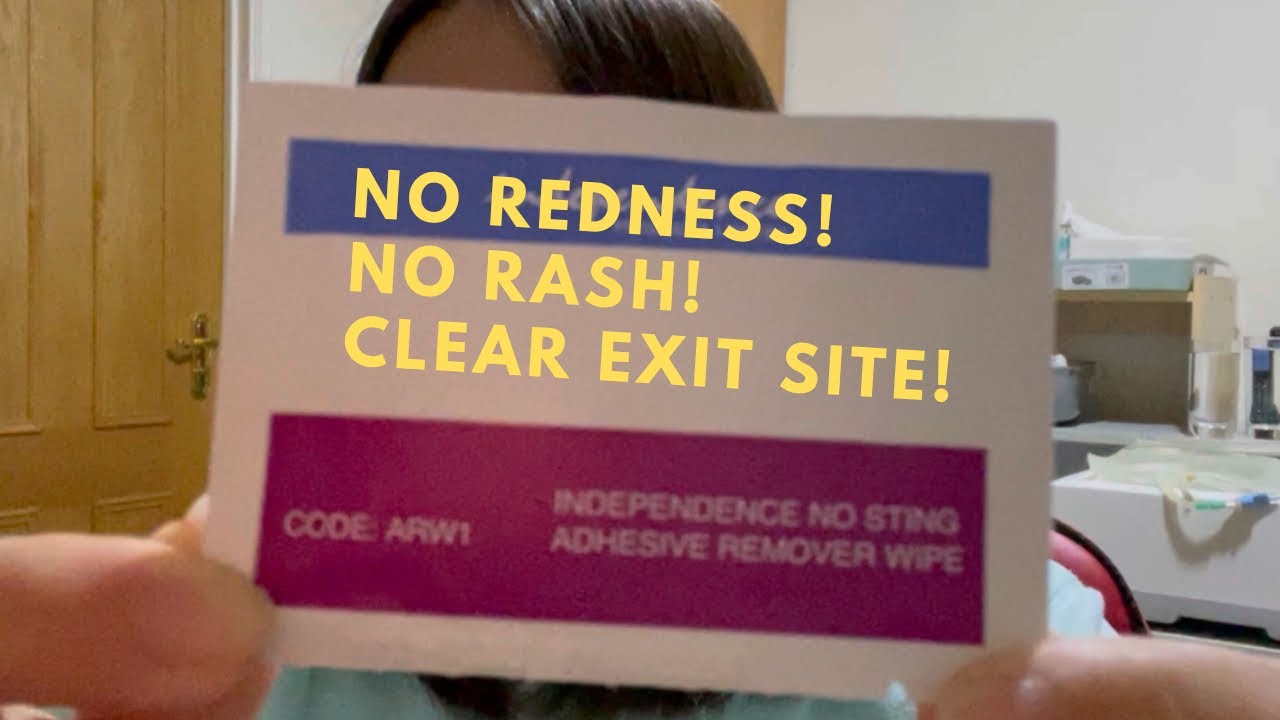 Exit Site Skincare Tips | Peritoneal Dialysis - YouTube