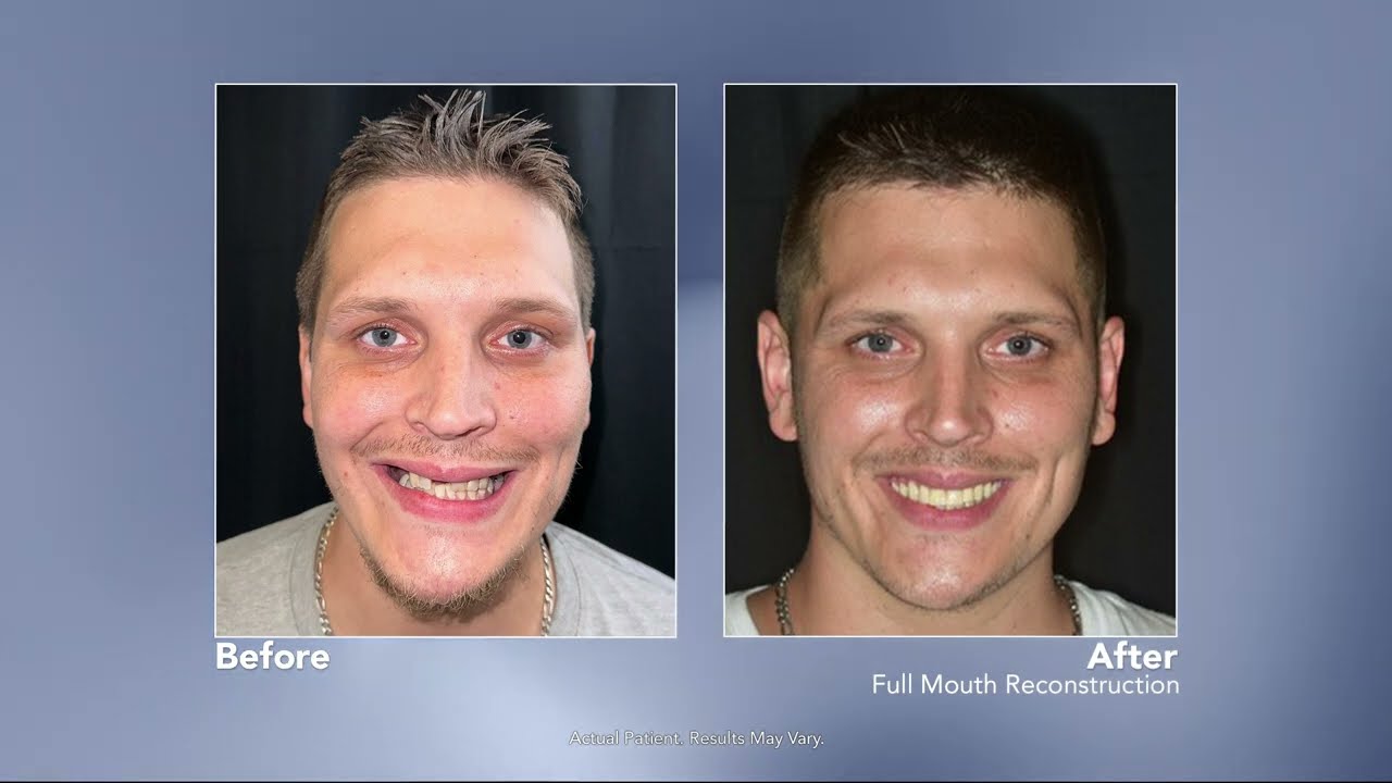 Extreme Smile Makeovers with Dr. M. Aruri | North Haven, CT dentist ...