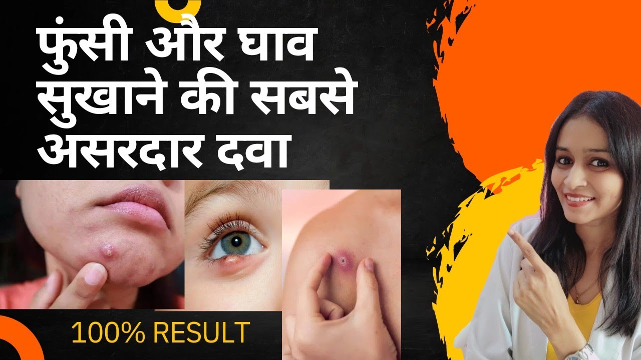 Septran DS tablet | Co- Trimethoprin | Suphamethoxazole, Uses, Dose ...