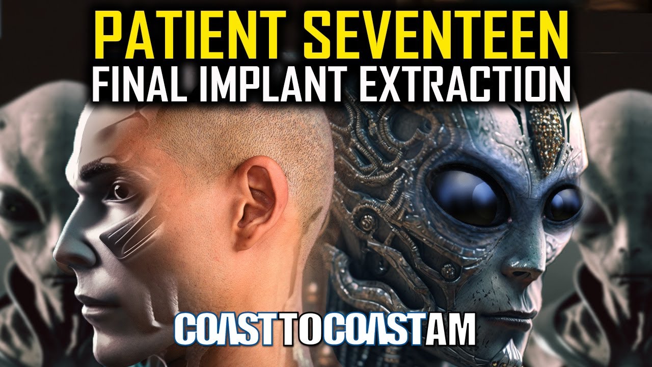 George Knapp on Patient Seventeen - the Final Alien Implant Extraction ...