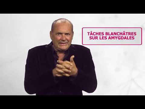 Angine blanche Symptômes, causes et traitements - YouTube