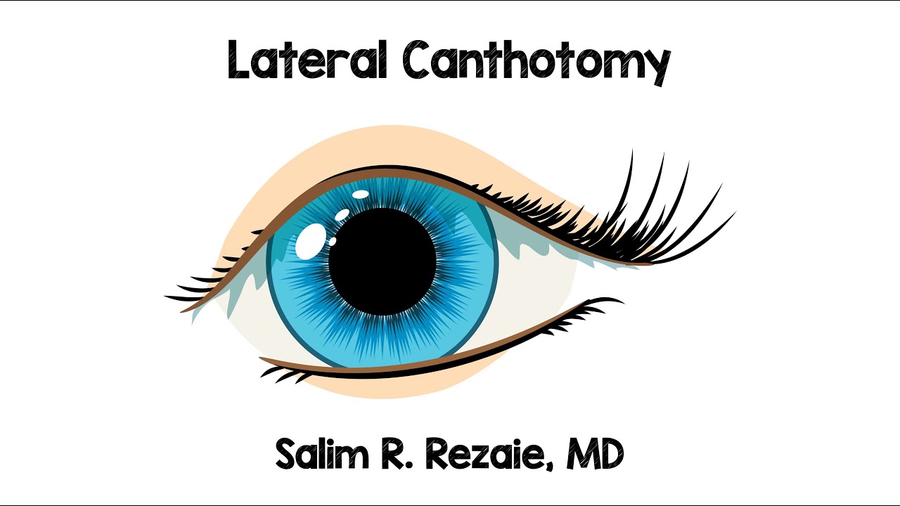 Lateral Canthotomy - YouTube