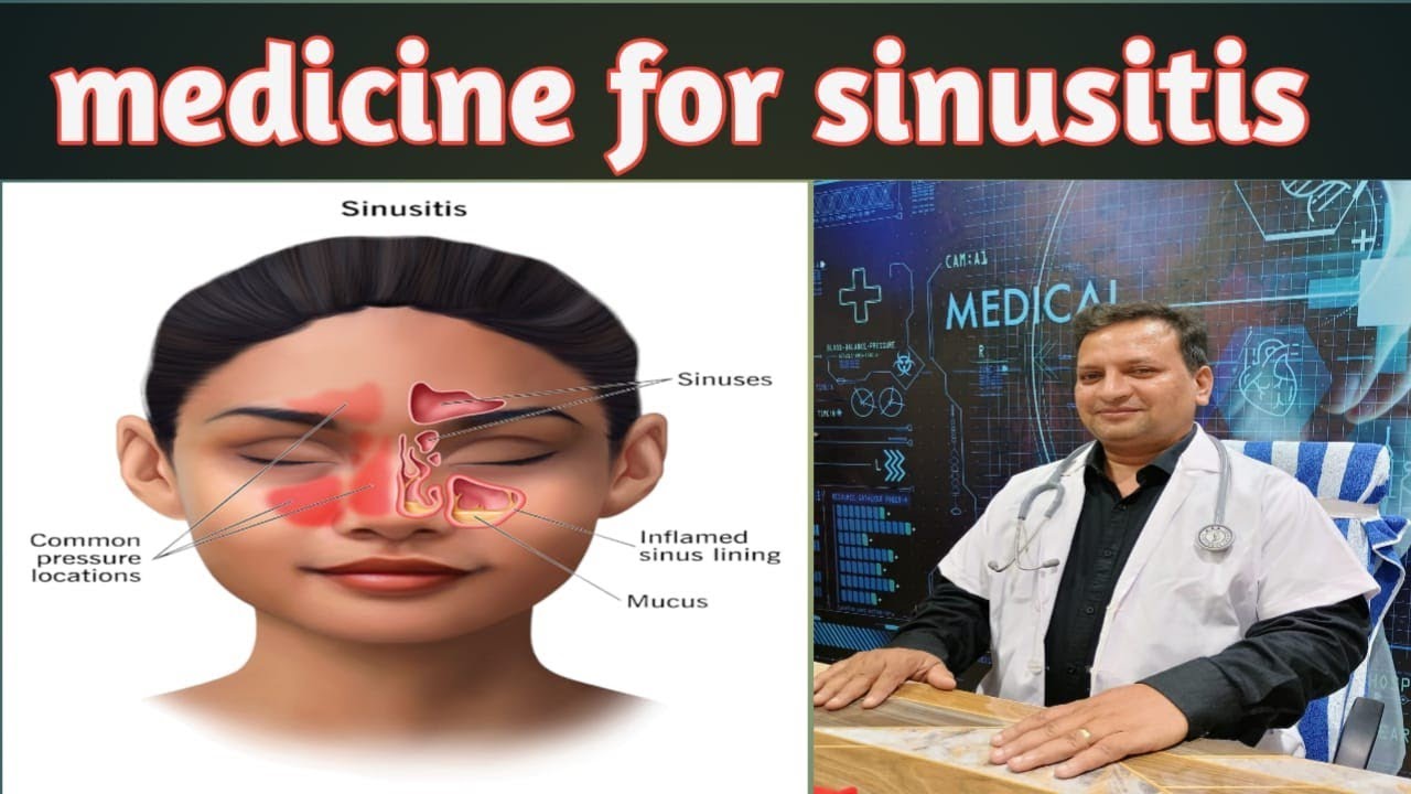 sinusitis # medicine for sinusitis # treatment of sinusitis ...