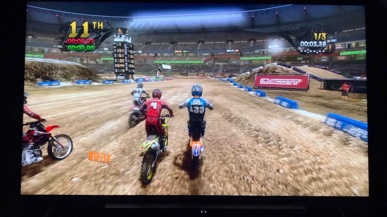 DAY BEFORE SURGERY - YouTube