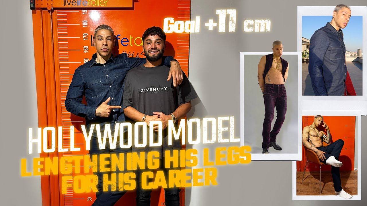 HOLLYWOOD MODEL LENGTHENING HIS LEGS FOR HIS CAREER - YouTube