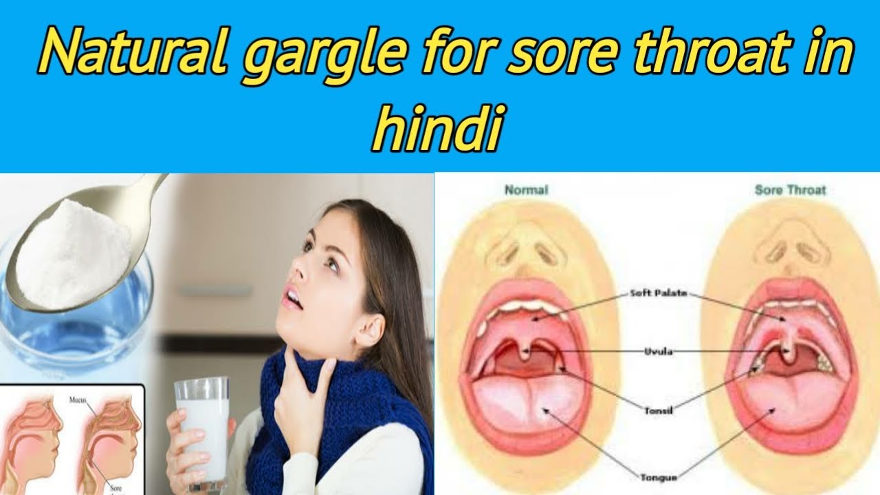 Natural gargle remedies for sore throat/SRM - YouTube