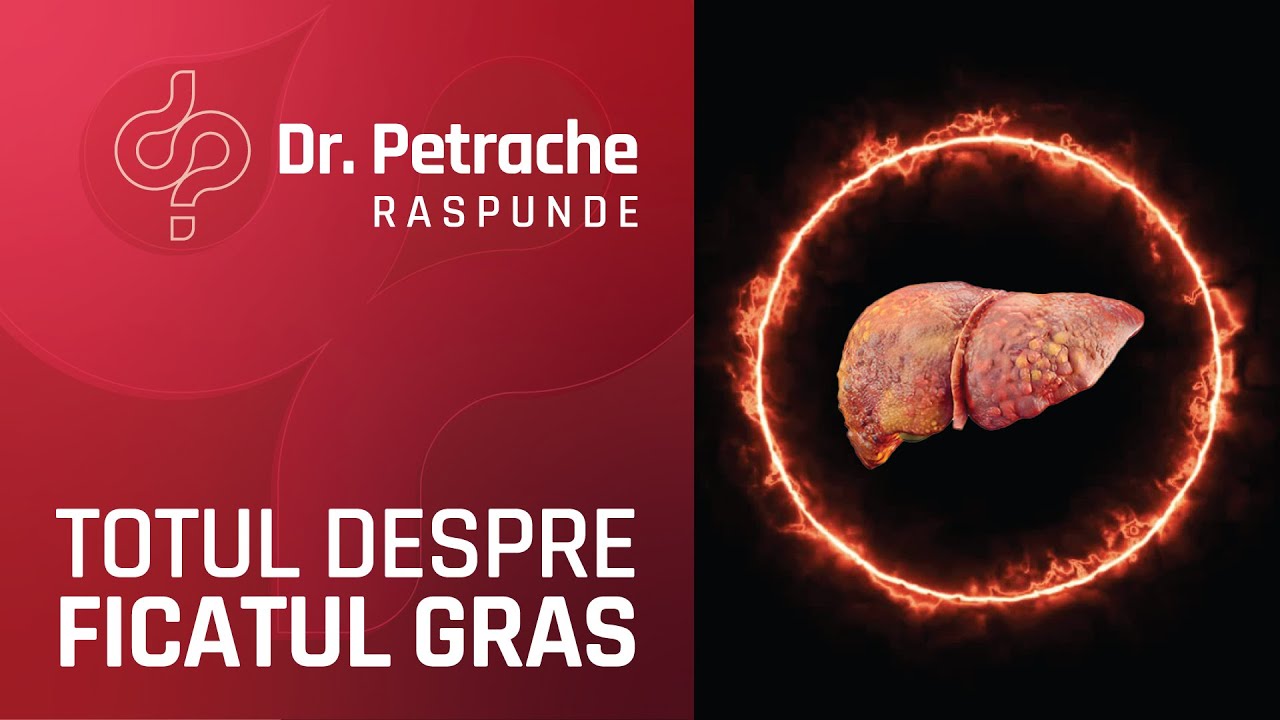 STEATOZA HEPATICA SAU FICATUL GRAS - YouTube
