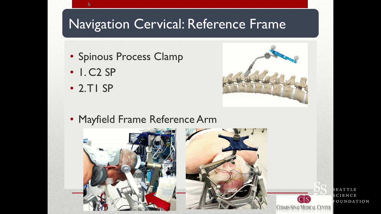 Navigating the Cervical Spine: Step by Step - Terrence Kim, MD - YouTube